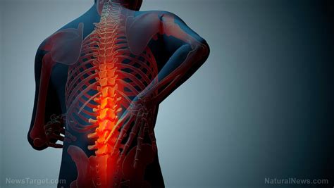 Sacrococcygeal Chordoma Causes Side Effects And Treatments At