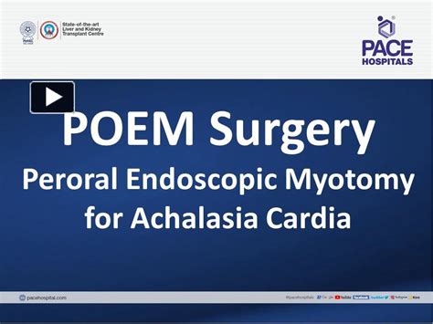 Ppt Poem Procedure Peroral Endoscopic Myotomy For Achalasia Cardia