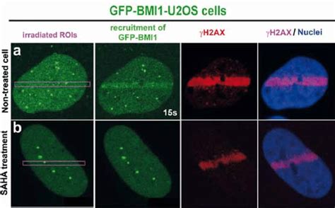 Acetylation Dependent Recruitment Of Bmi1 Protein To Uv Damaged