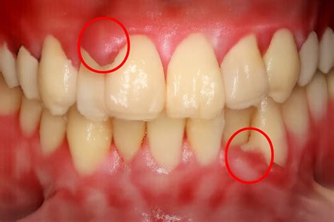 10 Common Dental Problems And Tooth Diseases