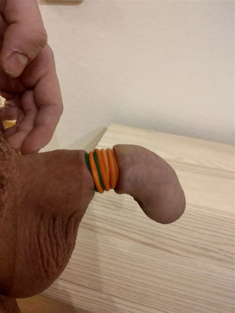 Extreme Cock Banding 10 Nude Pics Xhamster