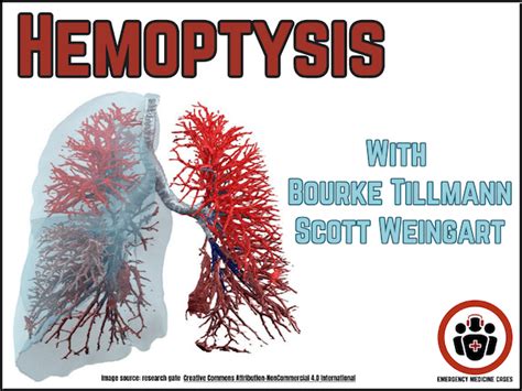 Hemoptysis Ed Approach And Management Em Cases
