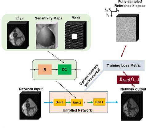 figure 1 from efficient training of 3d unrolled neural networks for mri