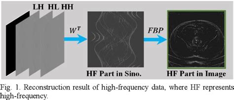 Figure From Stage By Stage Wavelet Optimization Refinement Diffusion Model For Sparse View Ct