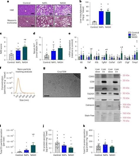 Liver Derived Extracellular Vesicles Improve Whole Body Glycaemic