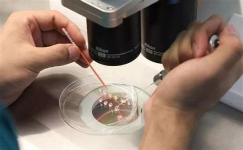 基因有问题做三代试管有用吗三代试管可以解决哪些遗传病 生活 天鹮网