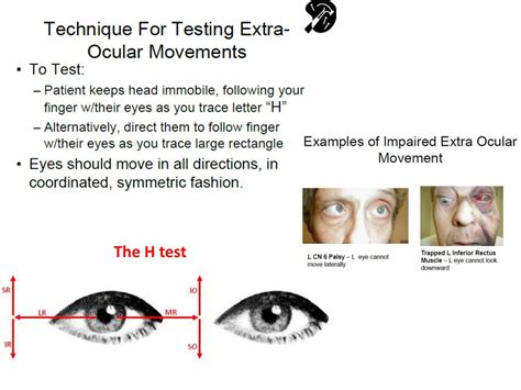 Ppt Visual System Examination Powerpoint Presentation Free Download
