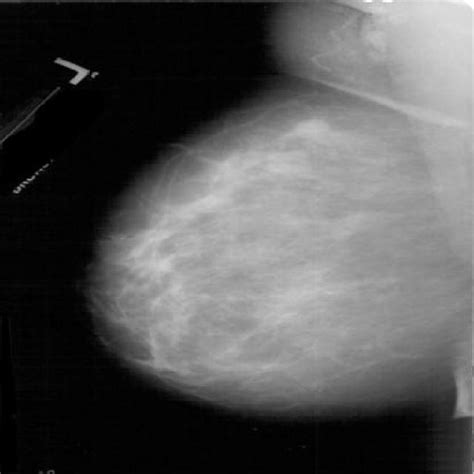 Article3 Object Detection Dataset V1 2023 08 16 6 34pm By Phd