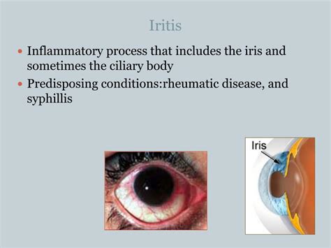 Ppt Ocular Emergencies Powerpoint Presentation Free Download Id