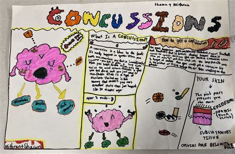 Concussion Posters Educate All A Patchwork Of Positive And Productive