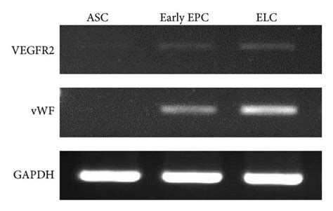 The Upregulation Of Endothelial Gene Expressions And Functional