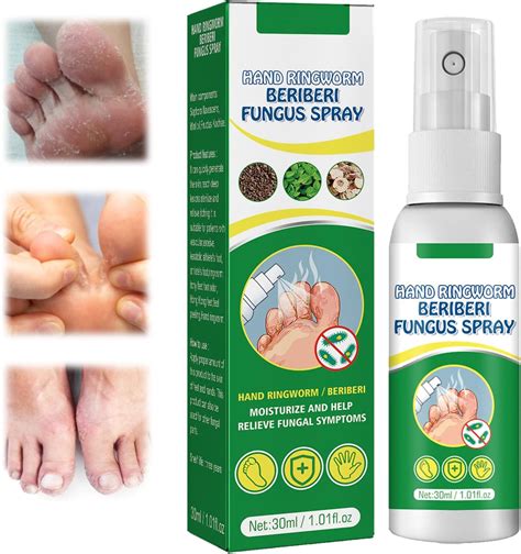 Silka Anti Fungal Cream Twin Pack Clinical Anti Fungus