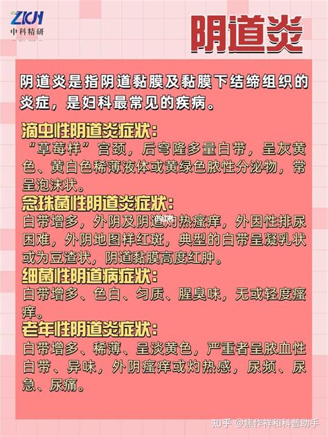 妇科炎症不重视小心并发症 知乎
