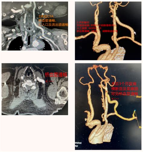 0df1a877 284a 4b32 Ba2e 7b9247bd16d0png