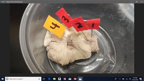 Hippocampus Dissection Diagram Quizlet