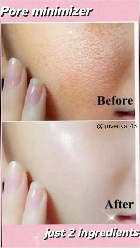 Remove Unwanted Facial Hair Artofit