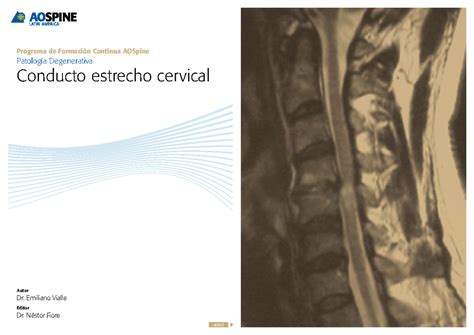 Estenosis Canal Medular Programa De Formación Continua Aospine