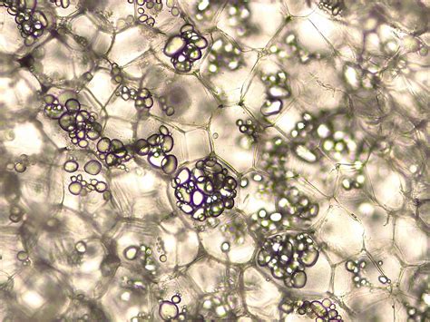 Amyloplasts 100xd Oval Amyloplasts Inside Polygon Shaped C Flickr