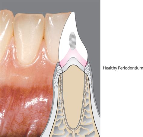 Fundamentals Pocket Dentistry