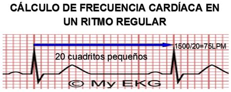 ELECTROCARDIOGRAFÍA BÁSICA PARA ENFERMERÍA FRECUENCIA CARDÍACA EN UN