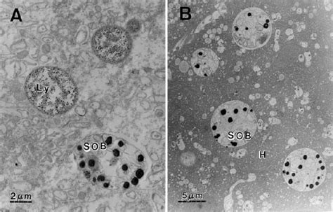Acid Phosphatase Detection In Lysosom