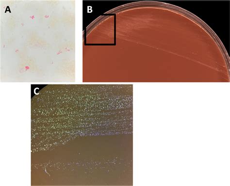 Gram Staining Of A Positive Blood Bottle Culture Total Magnification ×