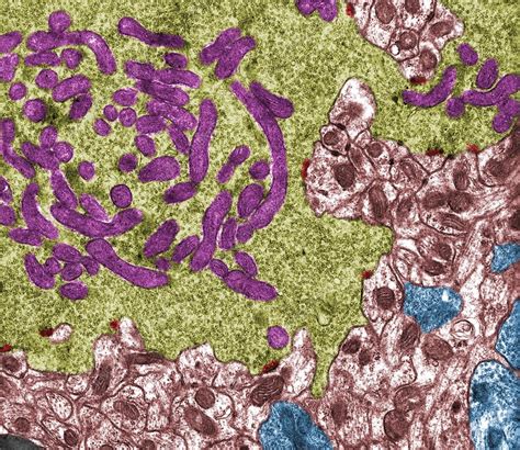 Cerebellar Glomerulus Tem Stock Image C053 4776 Science Photo Library