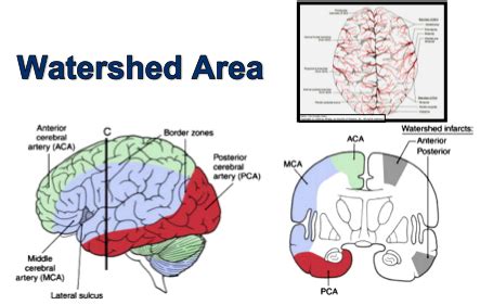 Cerebrovascular Disease Flashcards Quizlet