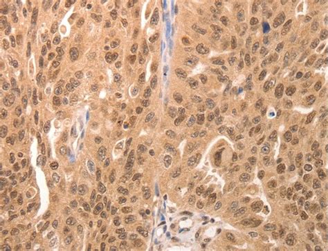 Anti Ap 1 Jund Antibody Rabbit Anti Human Polyclonal Elisaihc Lsbio