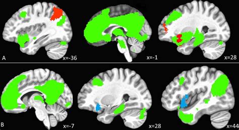 Positive Pcc And Mpfc Connectivity And Relations To Income Dynamics Download Scientific