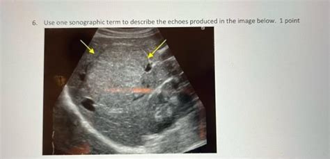 Solved 2 Use Two Sonographic Terms To Describe The Echo