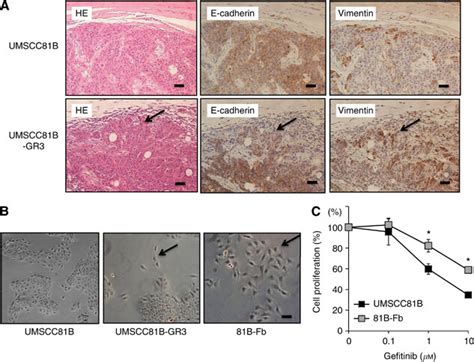 Isolation Of Fibroblastoid Subline With Emt Phenotype 81b Fb From