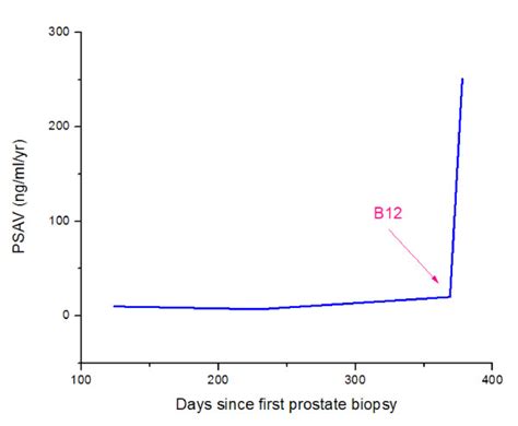 Prostate Specific Antigen Velocity Measurements Download Scientific Diagram