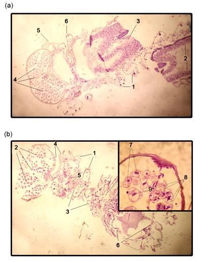 Light Microscopy Of The Gypsy Moth Larvae Histological Slides A