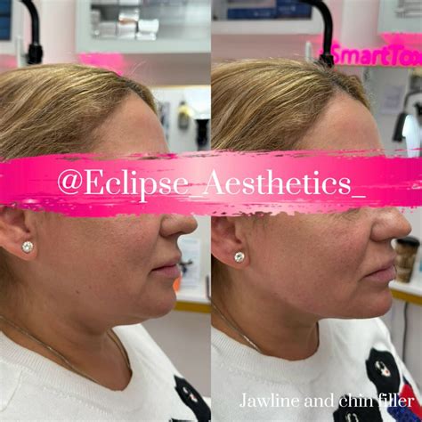 🚨 Absolutely Obsessed Eclipse Aesthetics Staten Island