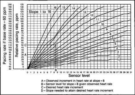 Utility Of Rate Histograms In Programming And Follow Up Of A Dddr Pacemaker Mayo Clinic