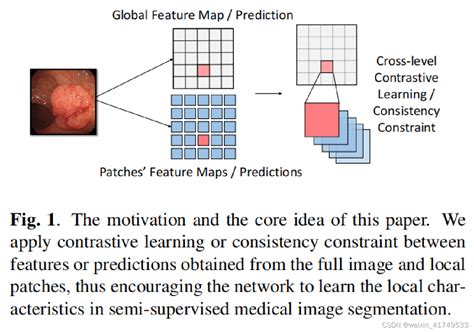 Cross Level Contrastive Learning And Consistency Constraint For Medical Image Segmentation Csdn博客