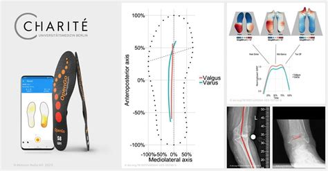 Moticon Ag On Linkedin Research Wearables Gaitanalysis Ganganalyse