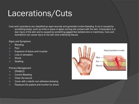 Types Of Cuts Laceration At Cole Sherrell Blog