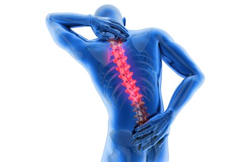 Thoracic Spine Disc Injury Symptoms At Clifford Bloss Blog