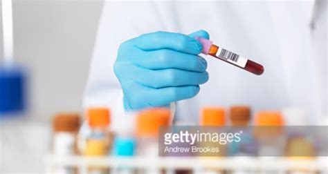 Элэгний С вирусын шинжилгээг ЭМД аар хийдэг боллоо