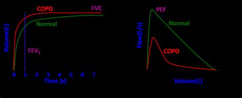 Typical Spirometric Flow Curves A Volume Time Curve And B