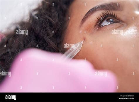 Syringe Needle Penetrates Under The Skin Under The Eye Along Pre Marked
