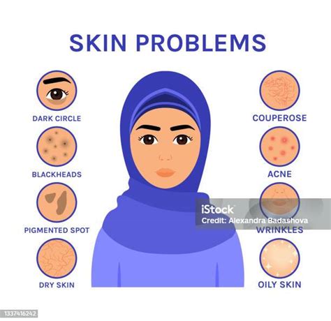 아름다운 젊은 무슬림 여성과 피부 문제 히잡에 있는 소녀의 얼굴의 의료 건강 치료 피부과 및 미용학 포스터 일러스트 뷰티 디자인 흰색 배경입니다 벡터 다크서클에 대한 스톡