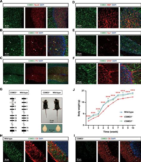 CSMD3 Deficiency Leads to Motor Impairments and Autism-Like Behaviors ...