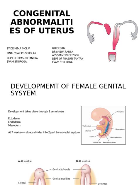 Congenital Abnormalities Of Uterus Pdf Uterus Reproductive System