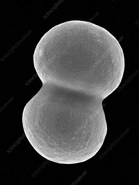 Staphylococcus Aureus SEM Stock Image C Science Photo Library
