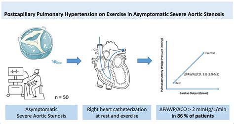 Diastolic Dysfunction Is Unmasked On Exercise In Patients With