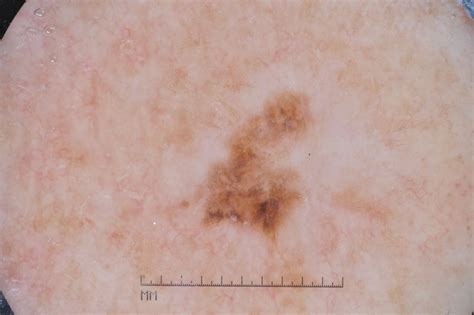 Examples Of Model Outputs When Using Different Pre Trained Feature