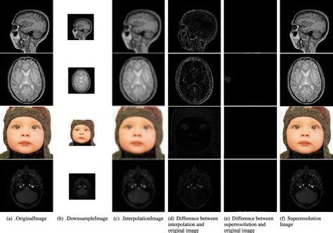 Figure 10 From Self Organized Maps And High Frequency Image Detail For Mri Image Enhancement